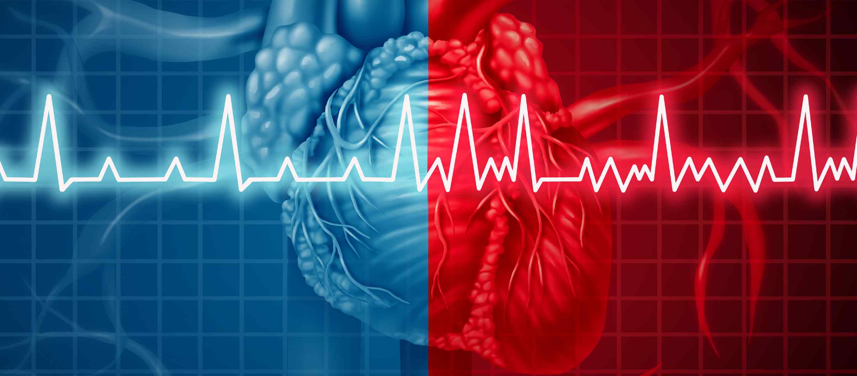 Cedars-Sinai Doctors Make Advancement in Sudden Cardiac Death Research ...