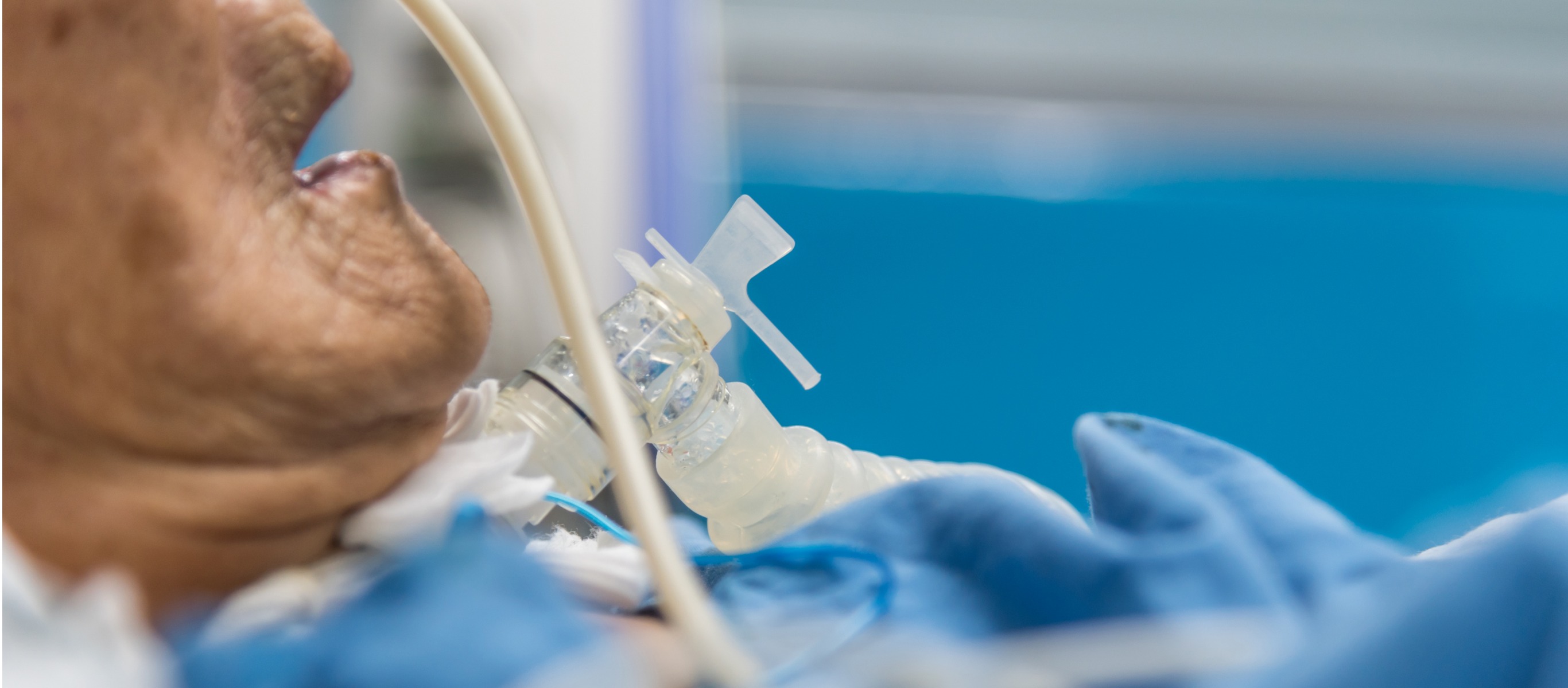 How to Implement an Effective Critical Care Resuscitation Unit ...